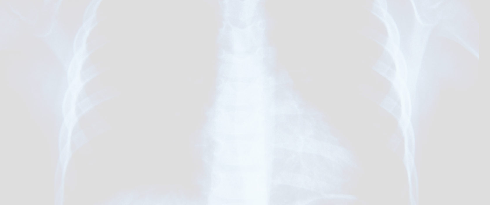 Mesothelioma - Simon Greenstone Panatier, PC